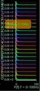 Create A Powerful EEG Chart Application With LightningChart
