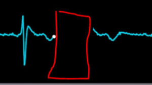 Code Your Own Sweeping Line Chart For Medical Healthcare