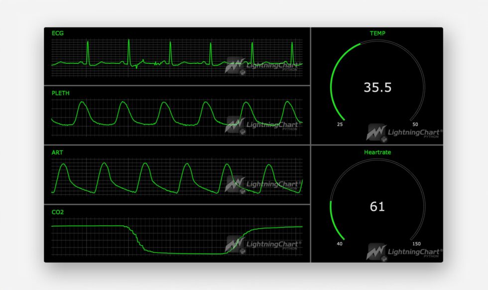 Implementation Of A Vital Signs Dashboard In Python