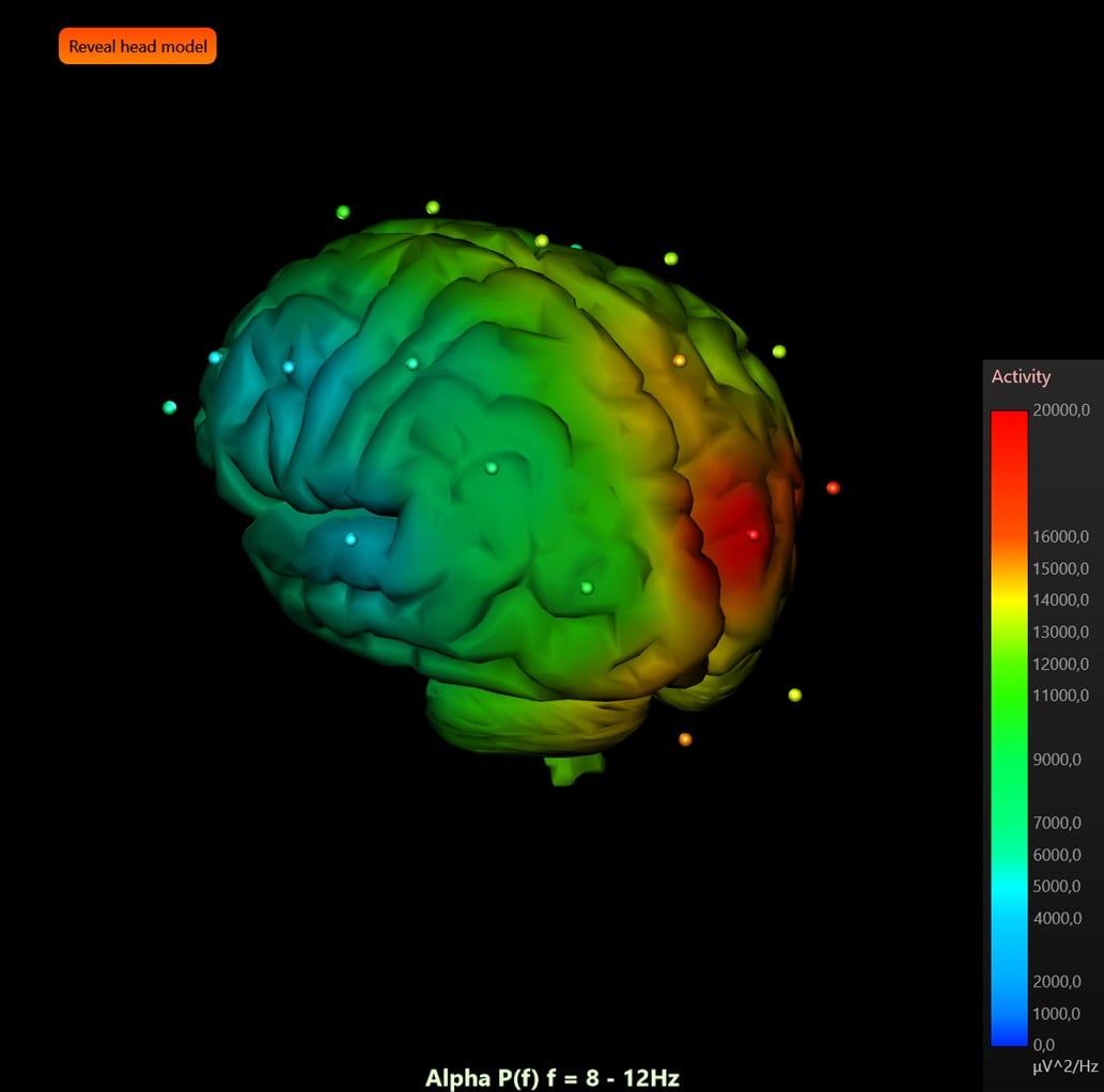 3d Medical Visualization A 3D Visualization‐based Augmented Reality