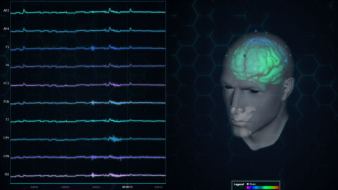 EEG Frequency Analysis, Methods, & EEG Data Best Practices